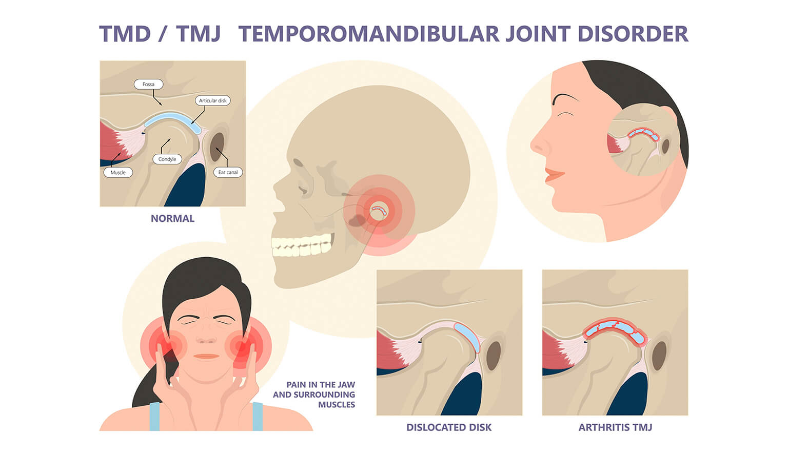 TMJ Treatment in India | Best TMJ Specialist in India | Kigo Dental Hyderabad