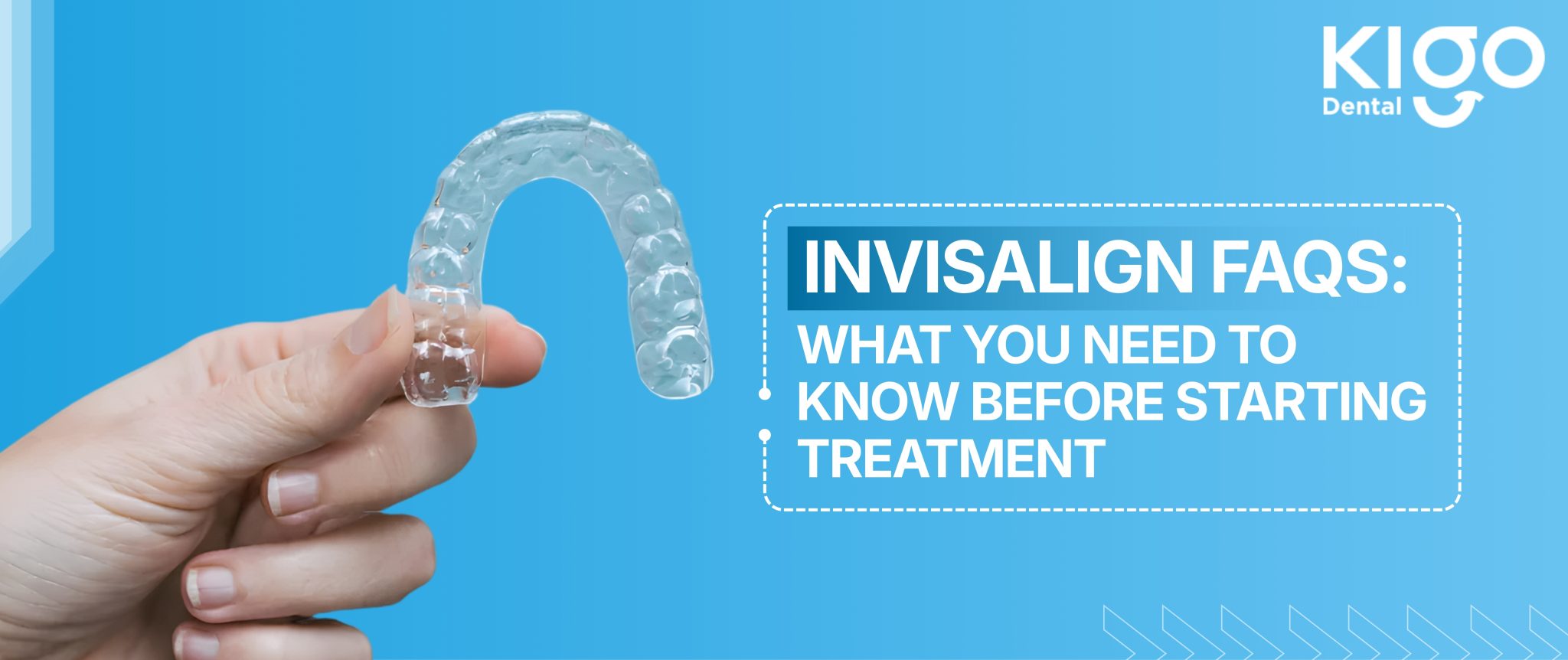 Invisalign FAQs: What You Need to Know Before Starting Treatment